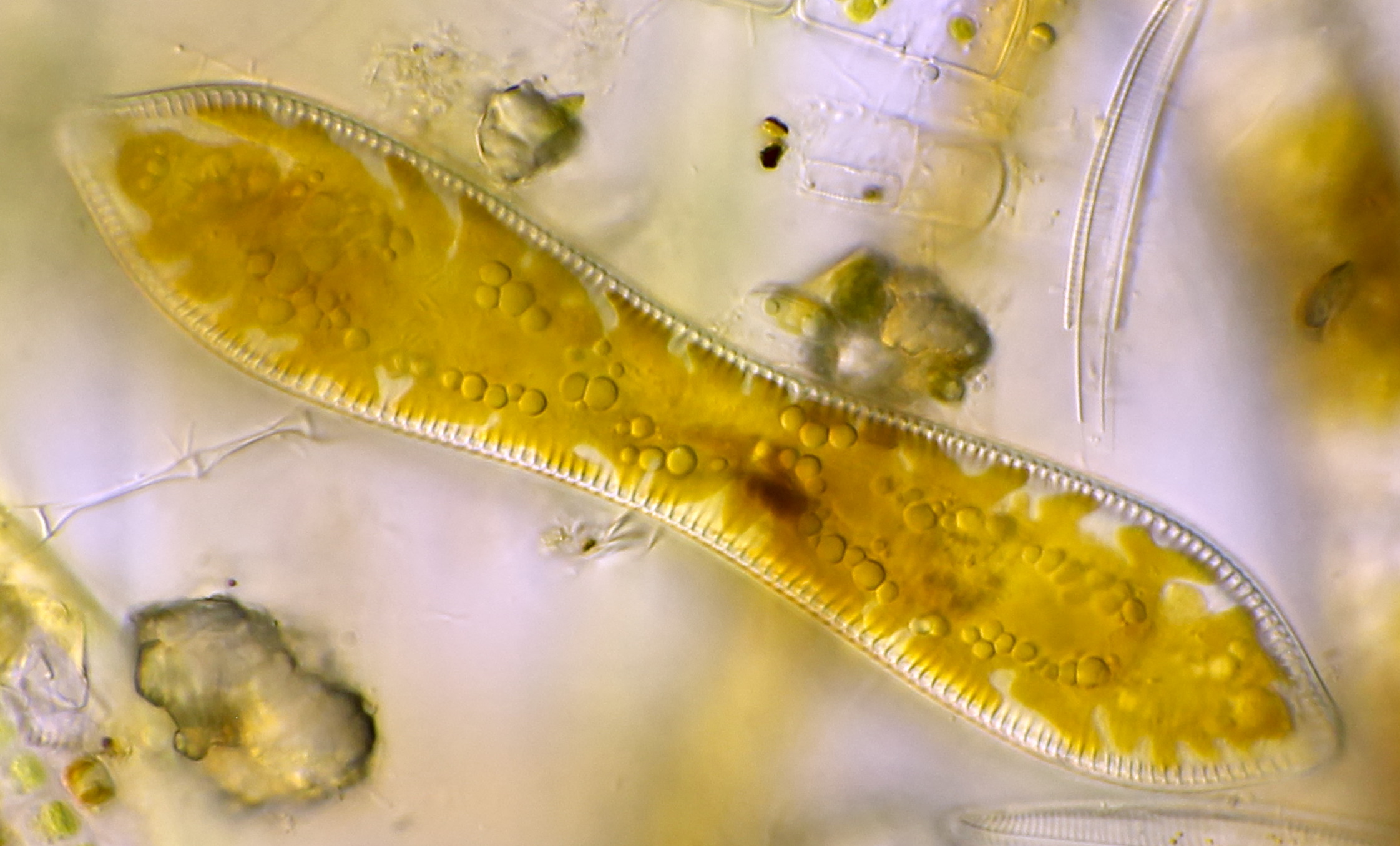 Diatoms | Microscopy of Nature